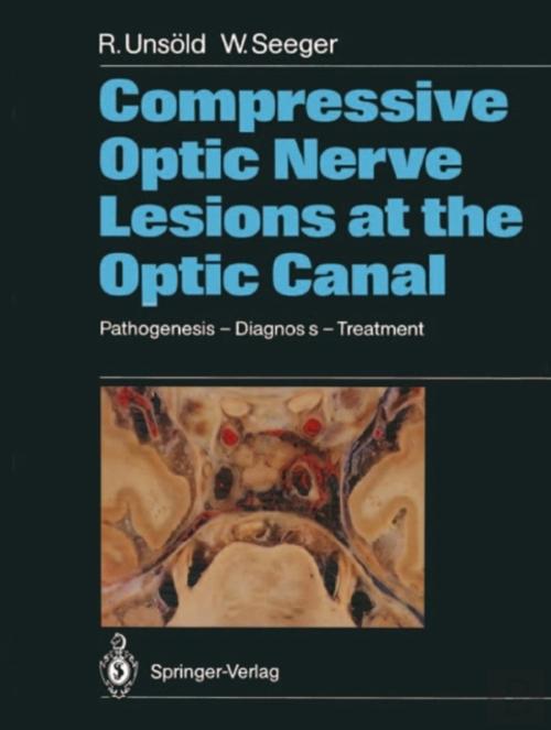 Compressive Optic Nerve Lesions At The Optic Canal, Wolfgang Seeger ...