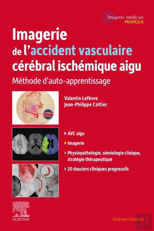 Imagerie De L'Accident Vasculaire Cérébral Ischémique Aigu : Méthode D ...